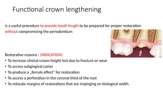 Esthetic crow lengthening surgery تطويل التيجان جراحيا.pptx