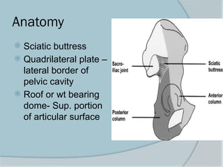 acetabular fracture lower limb orthopedic trauma | PPTX