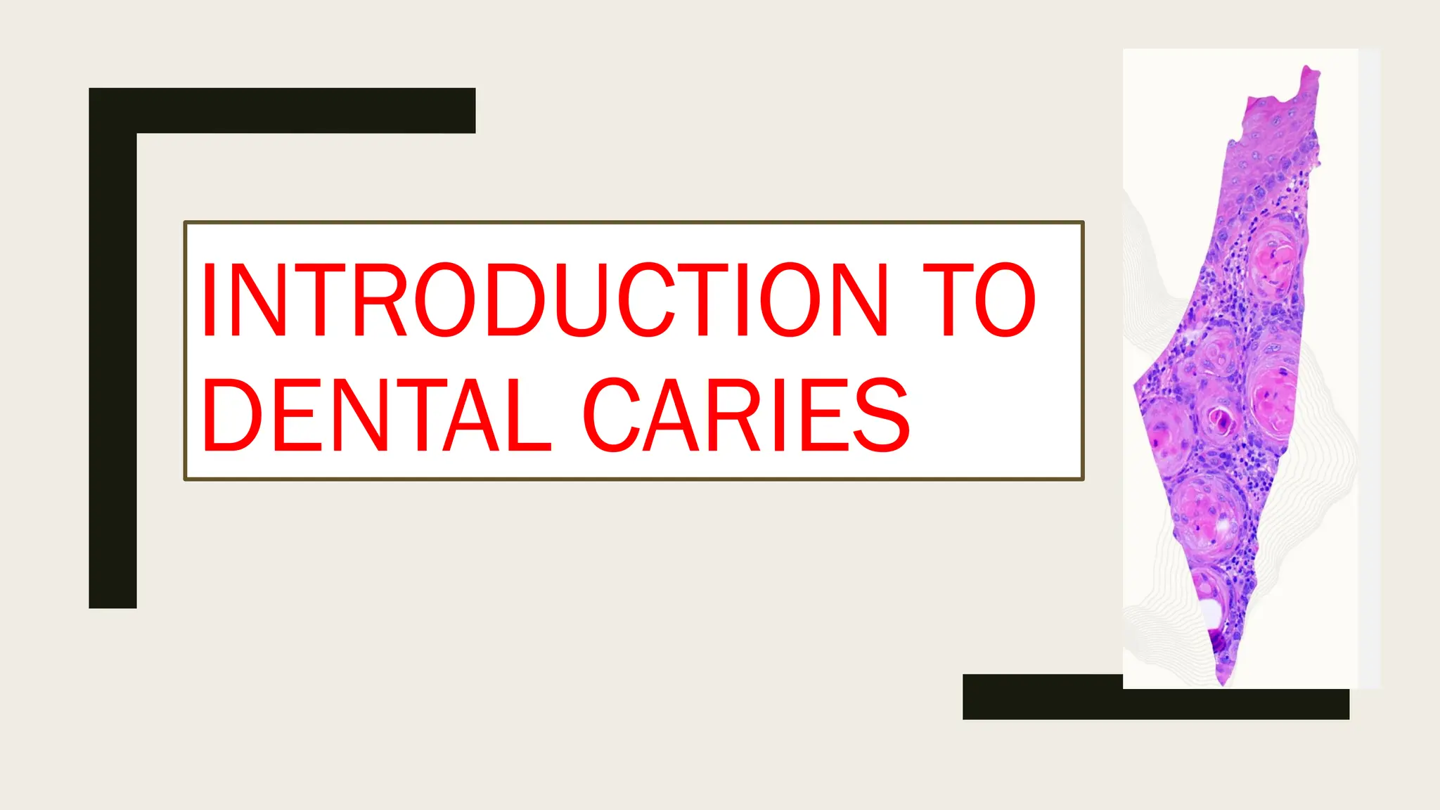 Introduction to dental caries oral pathology | PPTX