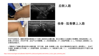 超声引导肘关节注射 Ultrasound-guided elbow joint injection | PPTX