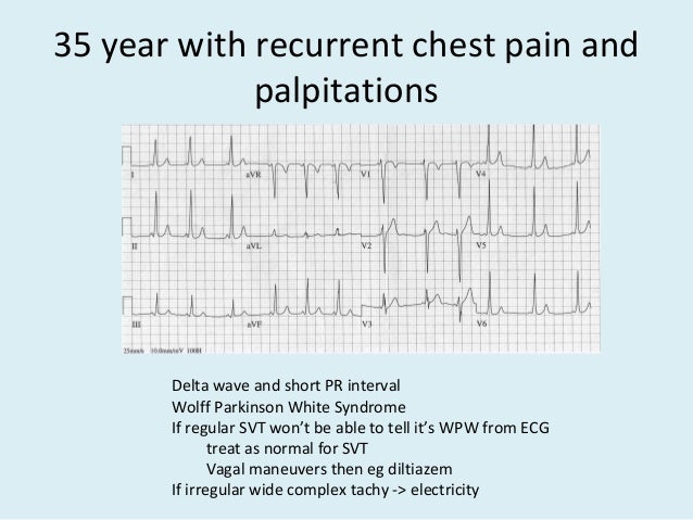 Icd 10 atrial flutter - merygod