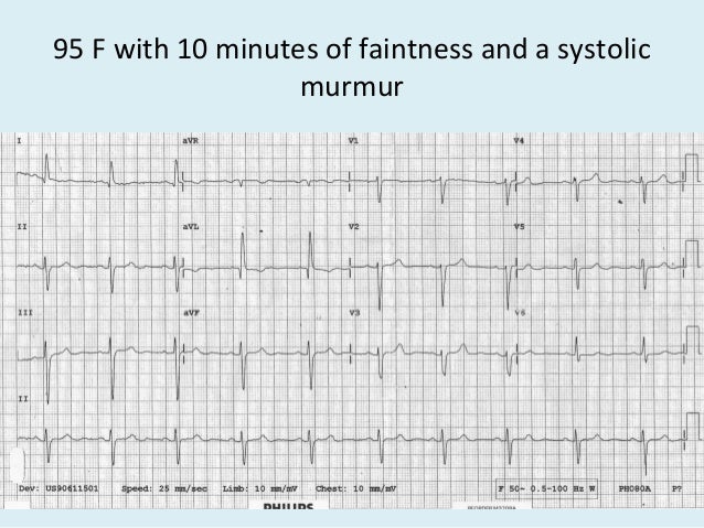Random ECGs 1