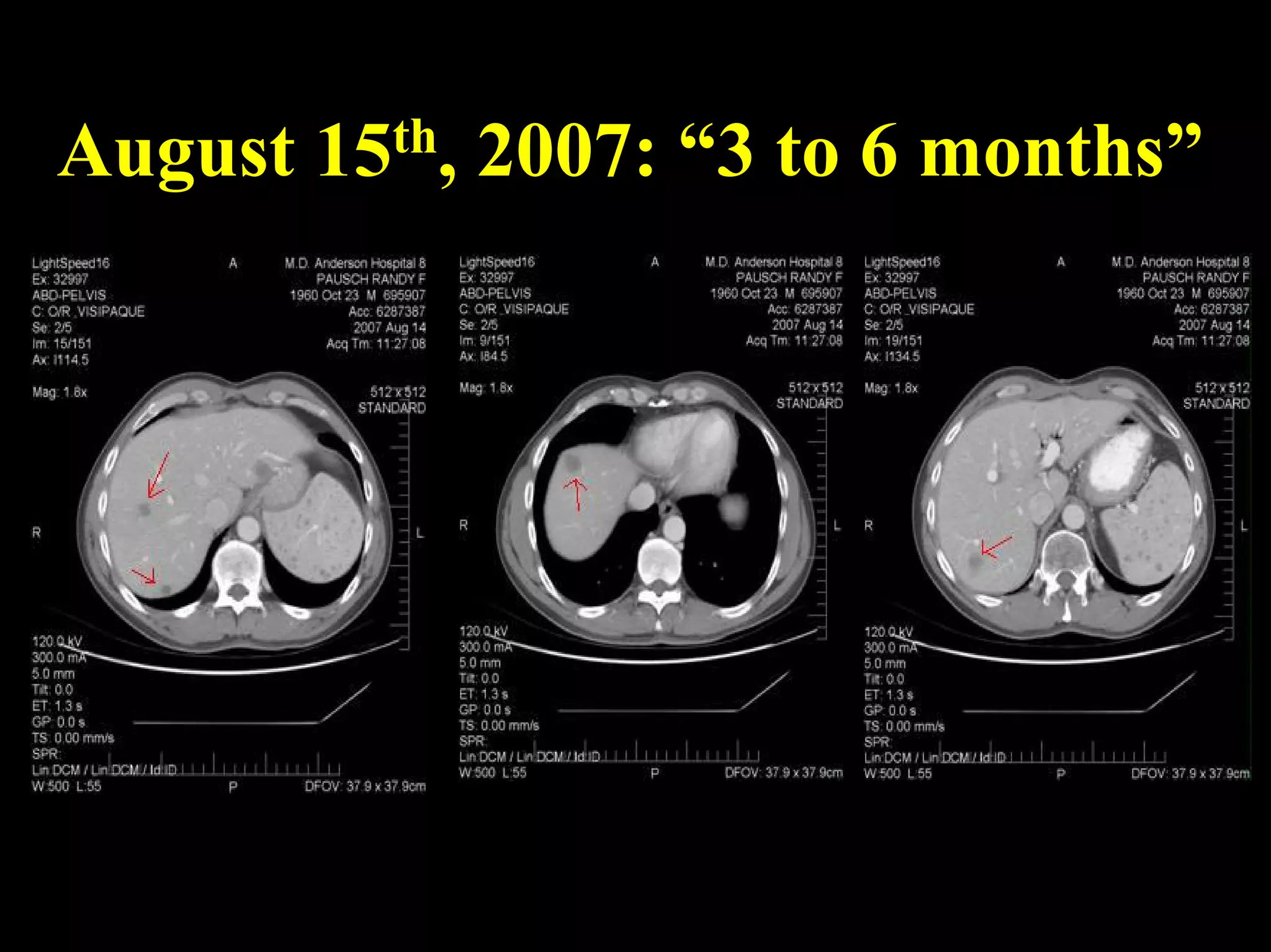 [兰迪·波许演讲 时间管理].Randy.pausch.time.management.slides | PDF