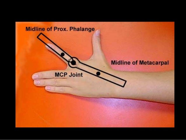 Range Of Motion Assessment