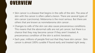 Non-Melanoma Skin Cancer | PPTX
