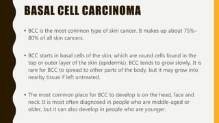 Non-Melanoma Skin Cancer | PPTX