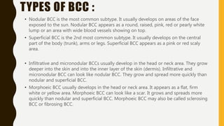 Non-Melanoma Skin Cancer | PPTX