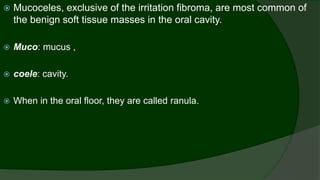 Ranula | PPTX