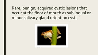 Ranula | PPTX