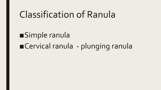 Ranula | PPTX