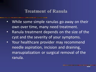 Ranula.Sustemic Surgery,Dental Surgery pdf | PDF