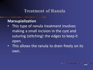 Ranula.Sustemic Surgery,Dental Surgery pdf | PDF
