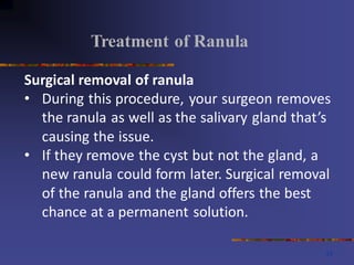 Ranula.Sustemic Surgery,Dental Surgery pdf | PDF