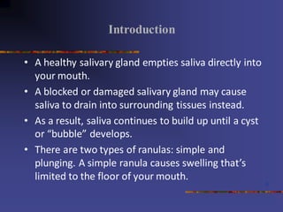 Ranula.Sustemic Surgery,Dental Surgery pdf | PDF