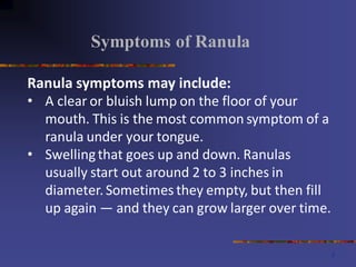 Ranula.Sustemic Surgery,Dental Surgery pdf | PDF