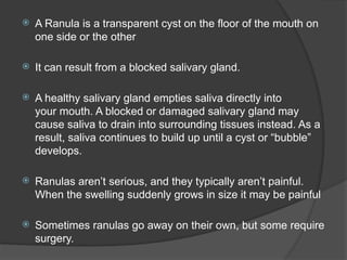 Ranula and its examination -surgery.pptx