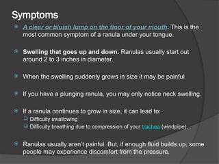 Ranula and its examination -surgery.pptx