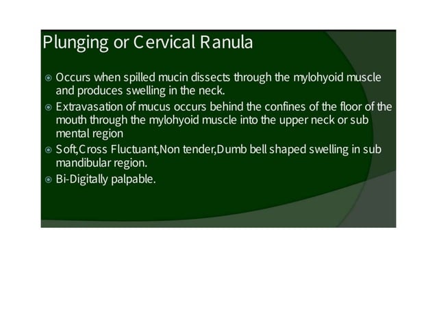 Ranula and plunging ranula | PPTX