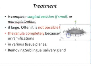 Ranula and plunging ranula | PPTX