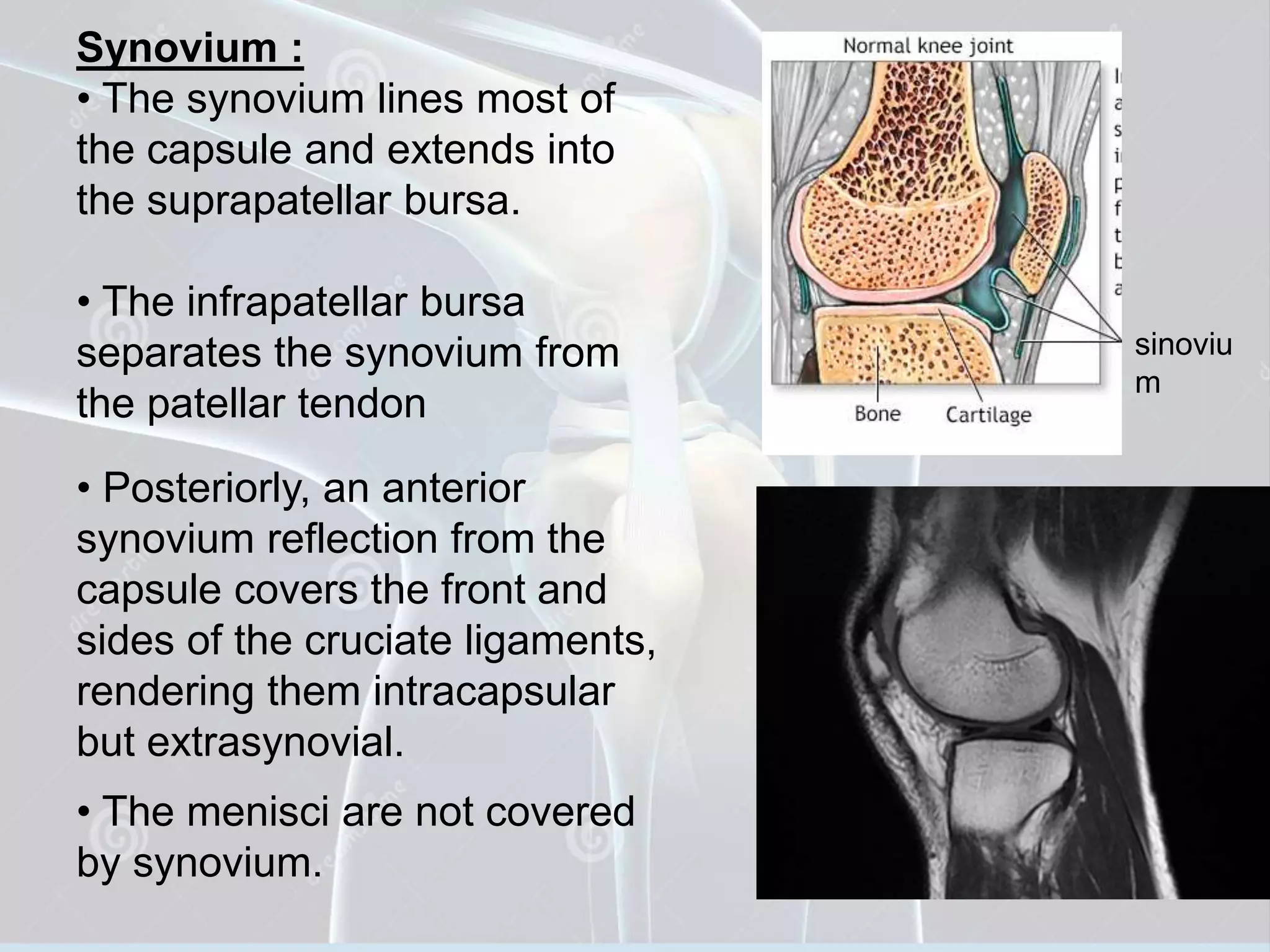 Radiological anatomy of Knee joint.pptx