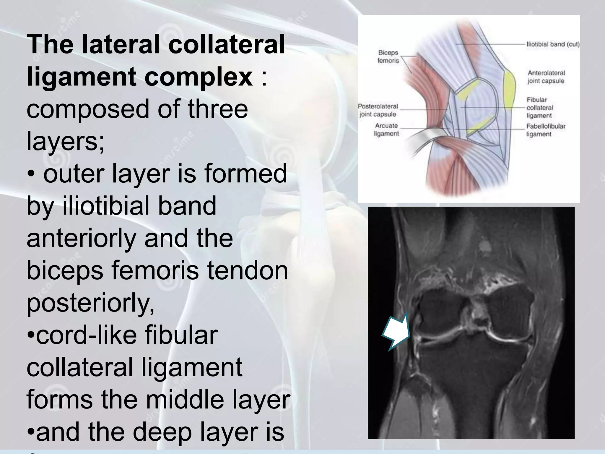 Radiological anatomy of Knee joint.pptx