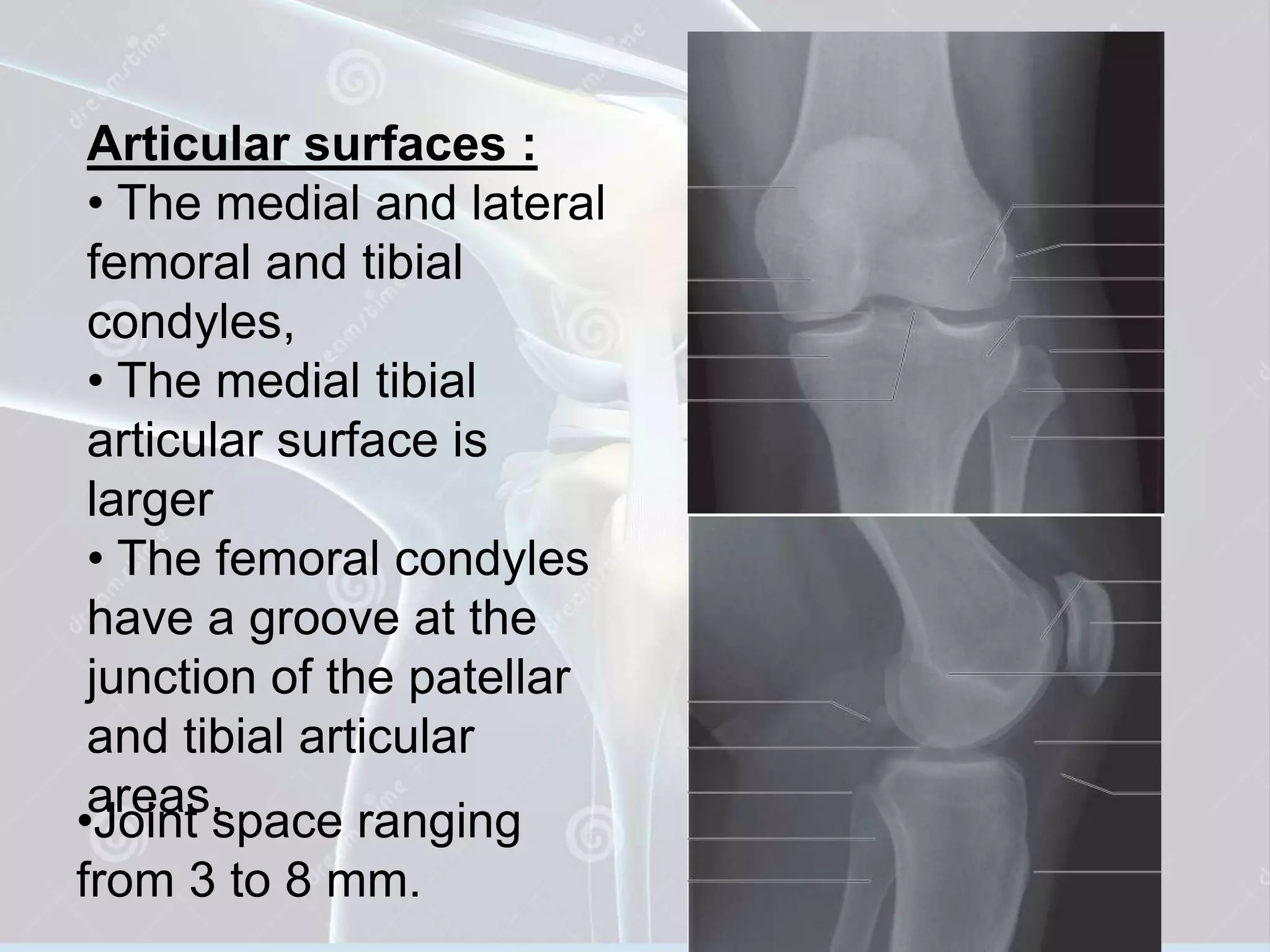 Radiological anatomy of Knee joint.pptx