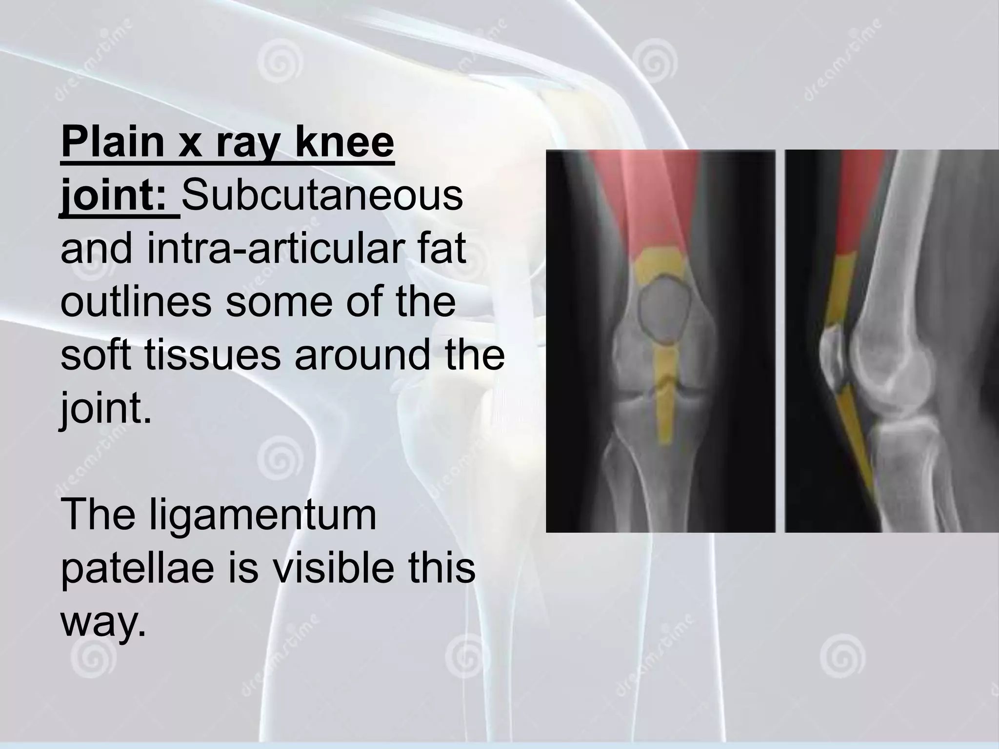 Radiological anatomy of Knee joint.pptx