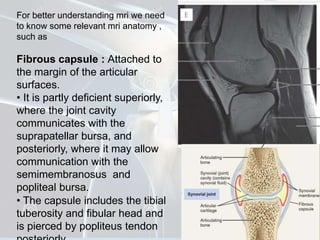 Radiological anatomy of Knee joint.pptx