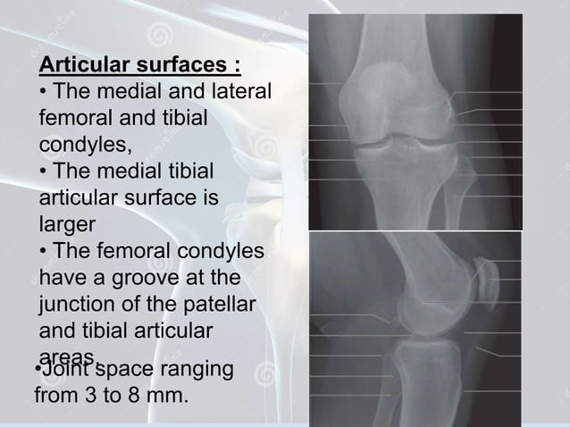 Radiological anatomy of Knee joint.pptx