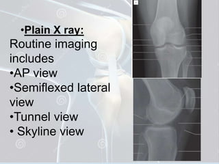 Radiological anatomy of Knee joint.pptx