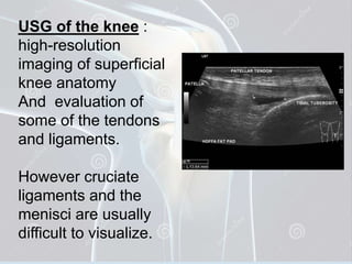 Radiological anatomy of Knee joint.pptx
