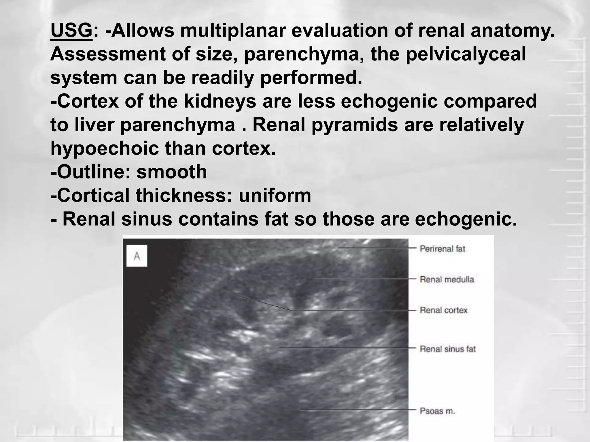 Radiological Anatomy of Kidney, uteter and urinary bladder.pptx | PPTX