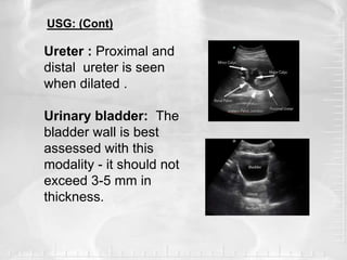 Radiological Anatomy of Kidney, uteter and urinary bladder.pptx | PPTX