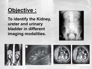 Radiological Anatomy of Kidney, uteter and urinary bladder.pptx | PPTX