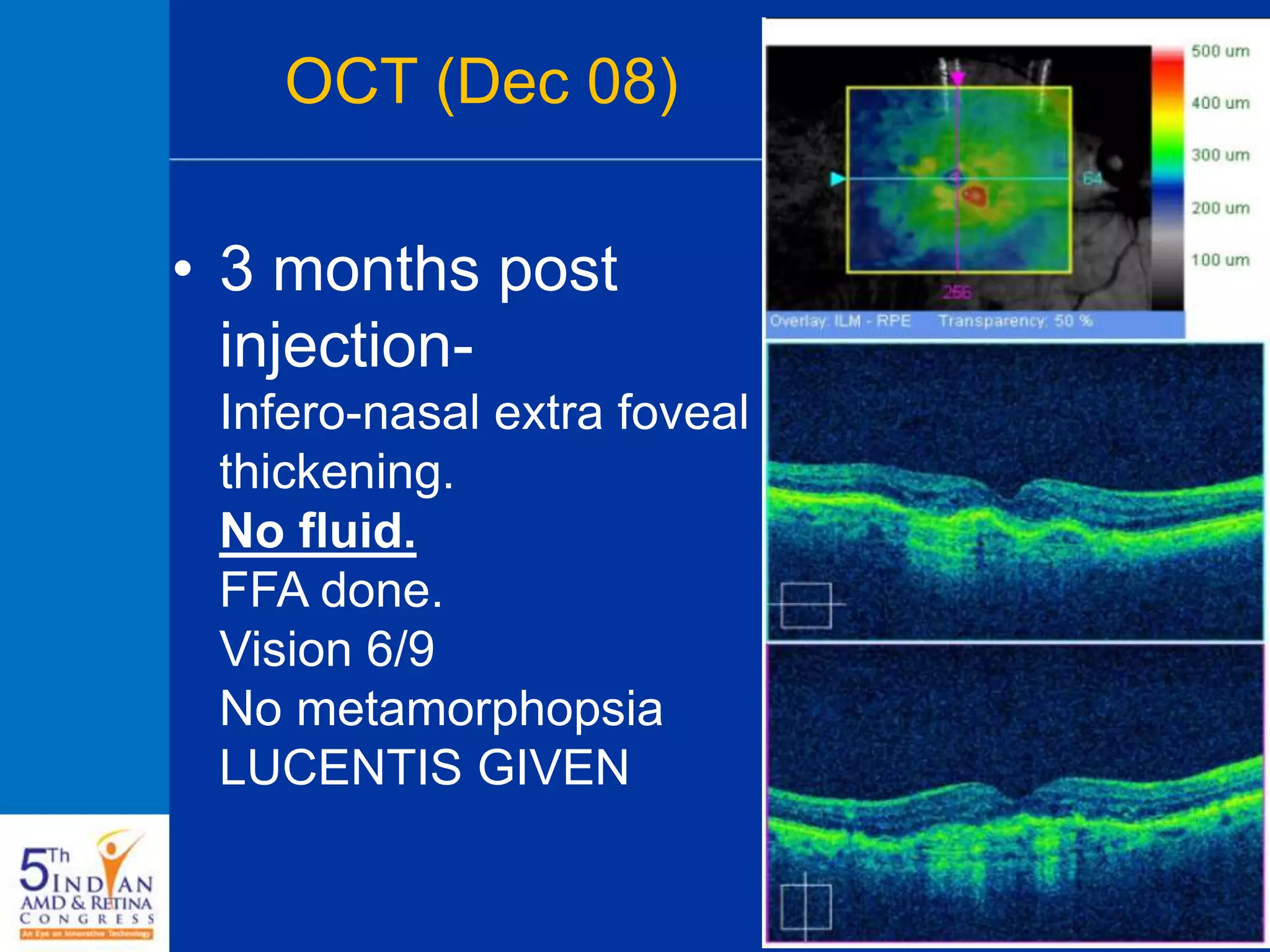 RAP TYPE 3 CNVM -AJAY DUDANI | PPTX