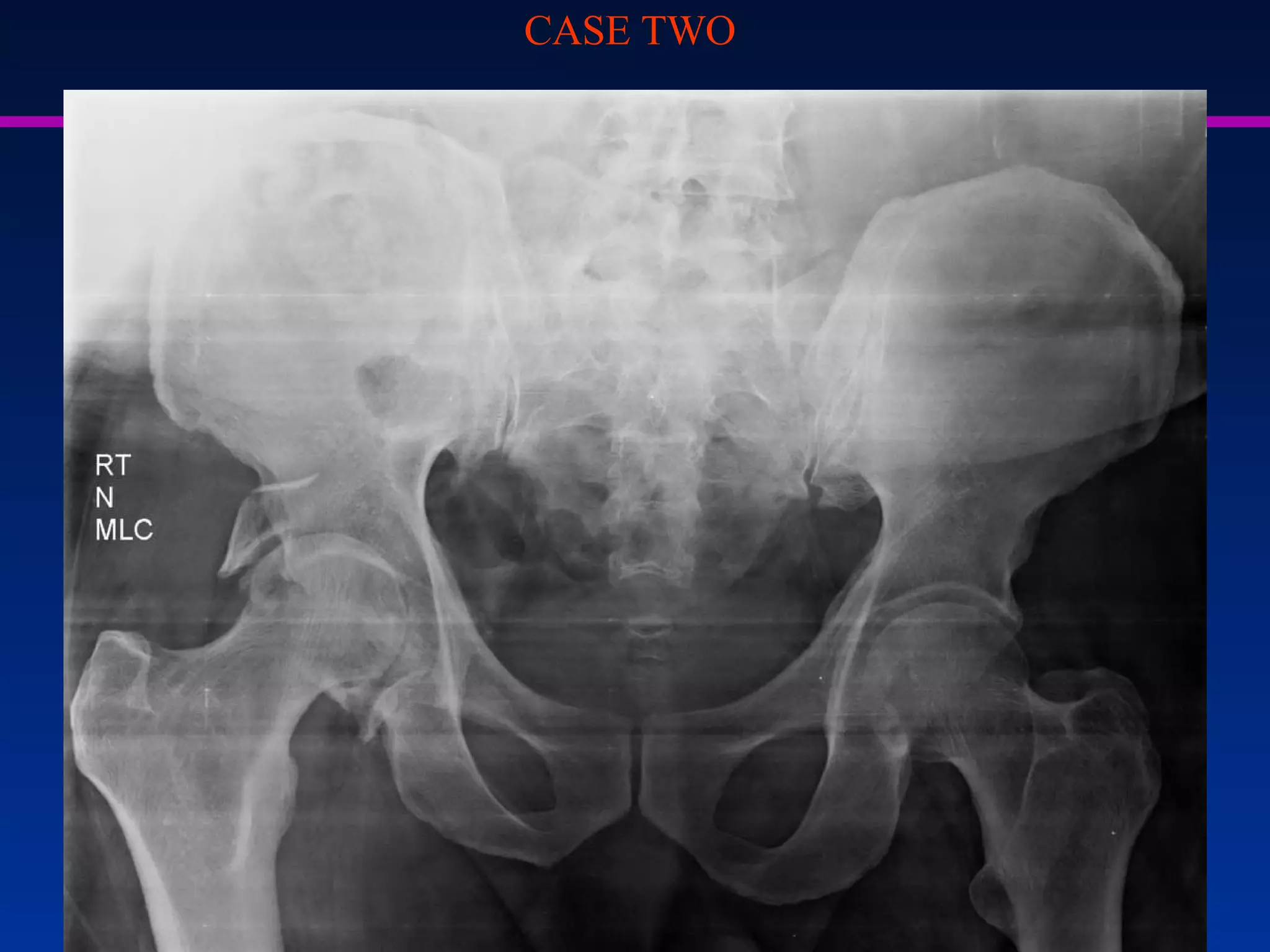 Rapid Reporting Segment 2.Ppt | PPT | Free Download