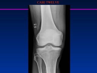 Rapid Reporting Segment 2.Ppt | PPT