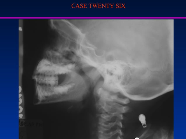 Rapid Reporting Segment 2.Ppt | PPT