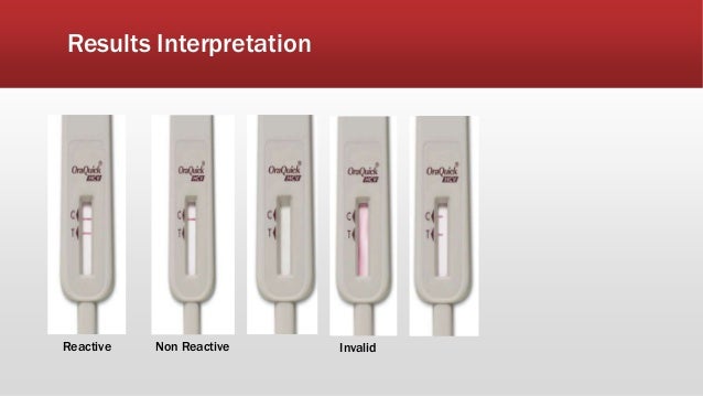Rapid detection of hepatitis c (ora quick)