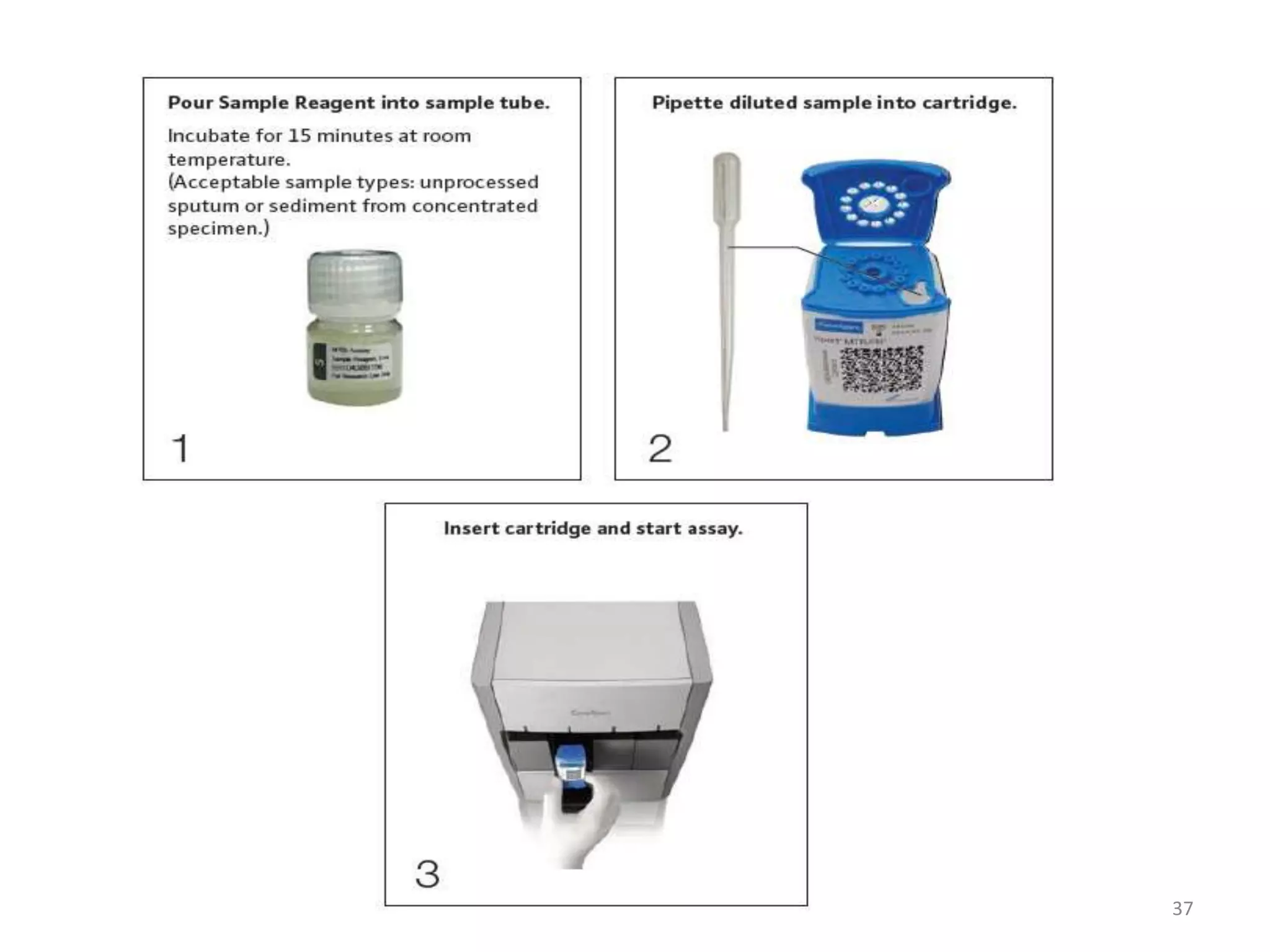 Rapid Detection Of Multi Drug Resistant Tuberculosis Pptx Lung And