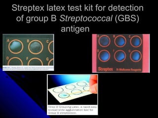 Rapid diagnosis of infectious diseases | PPT