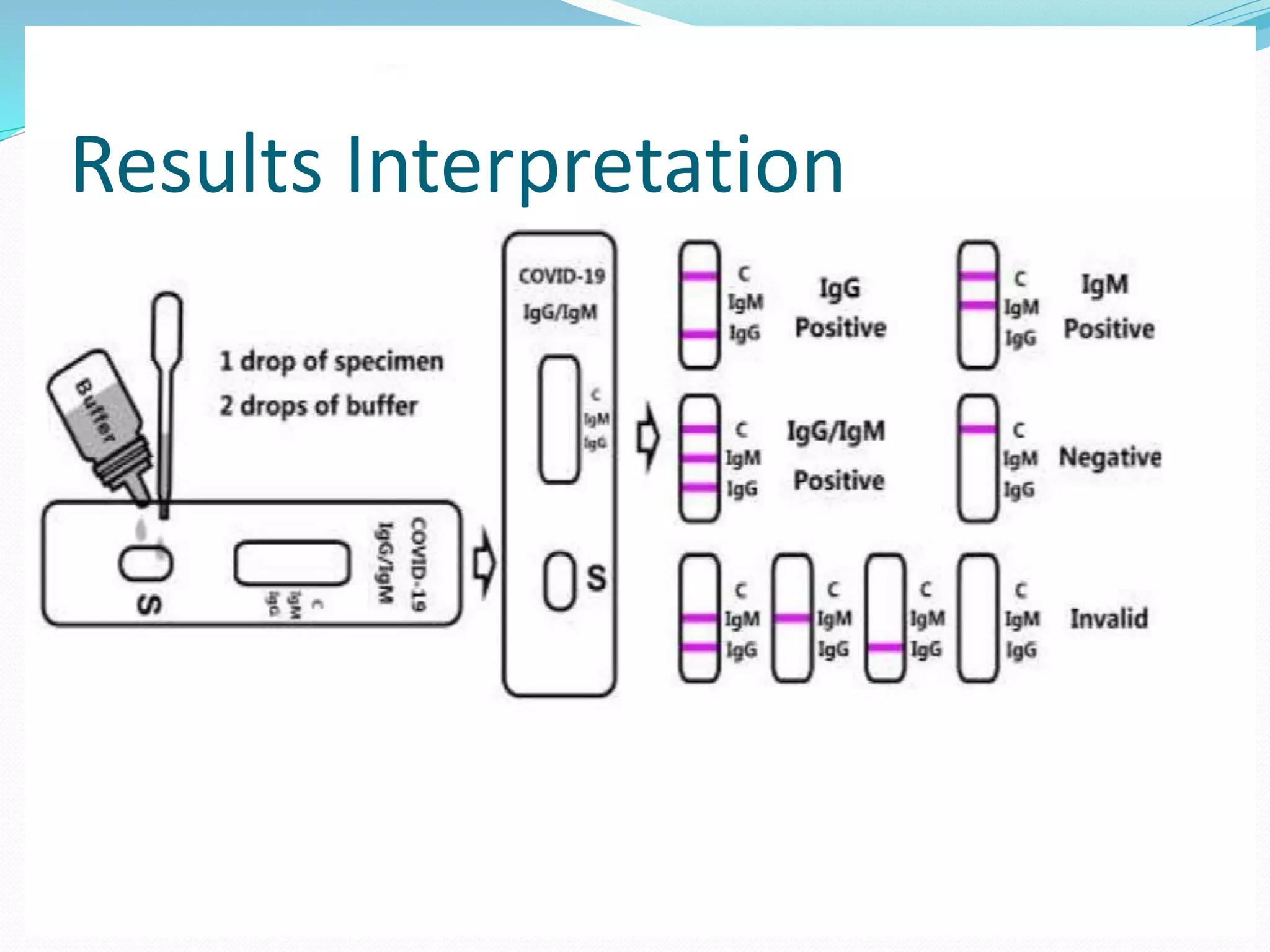 Rapid diagnostic test for covid 19, Corona | PDF