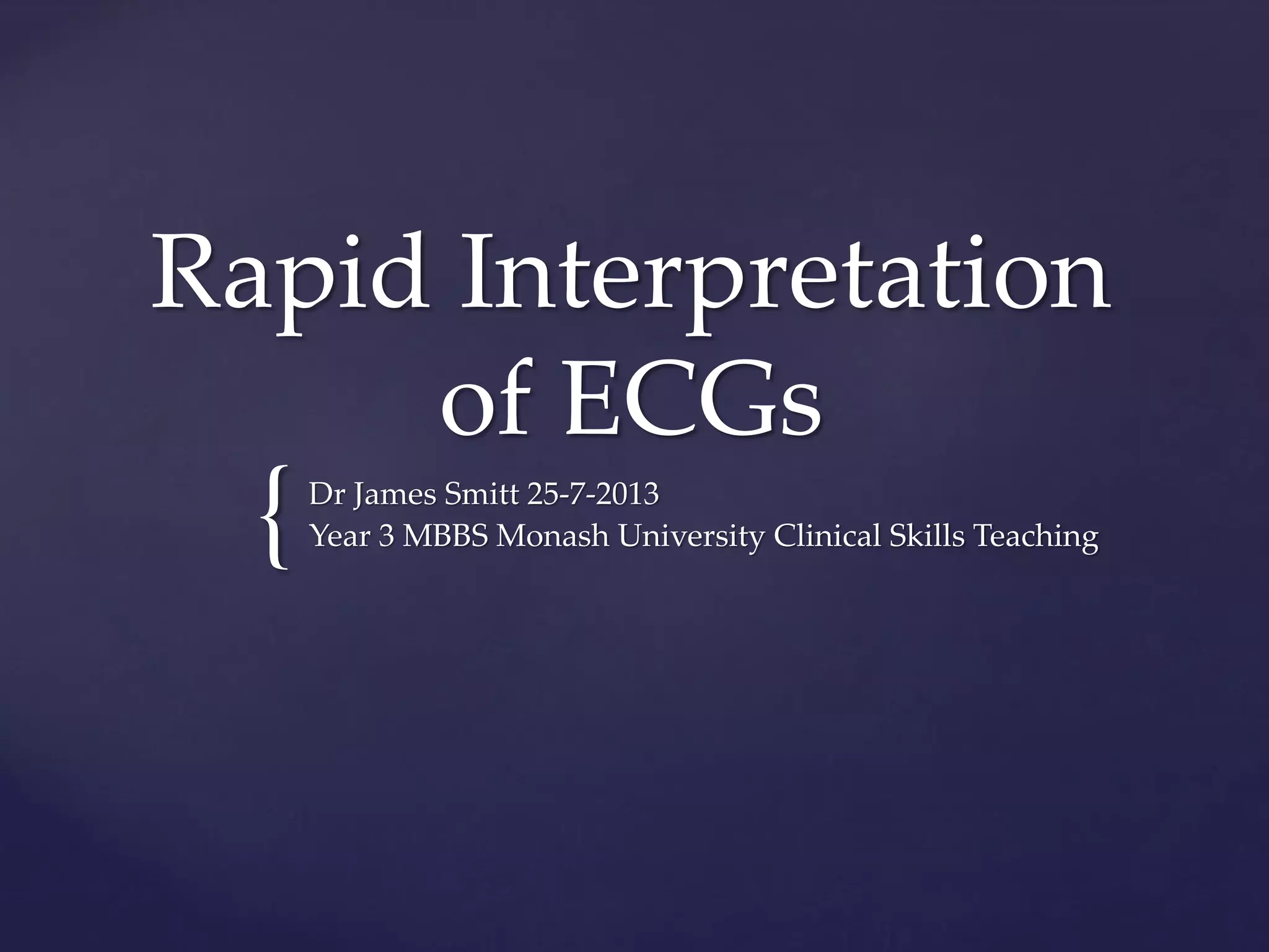Rapid interpretation of ECG | PPT