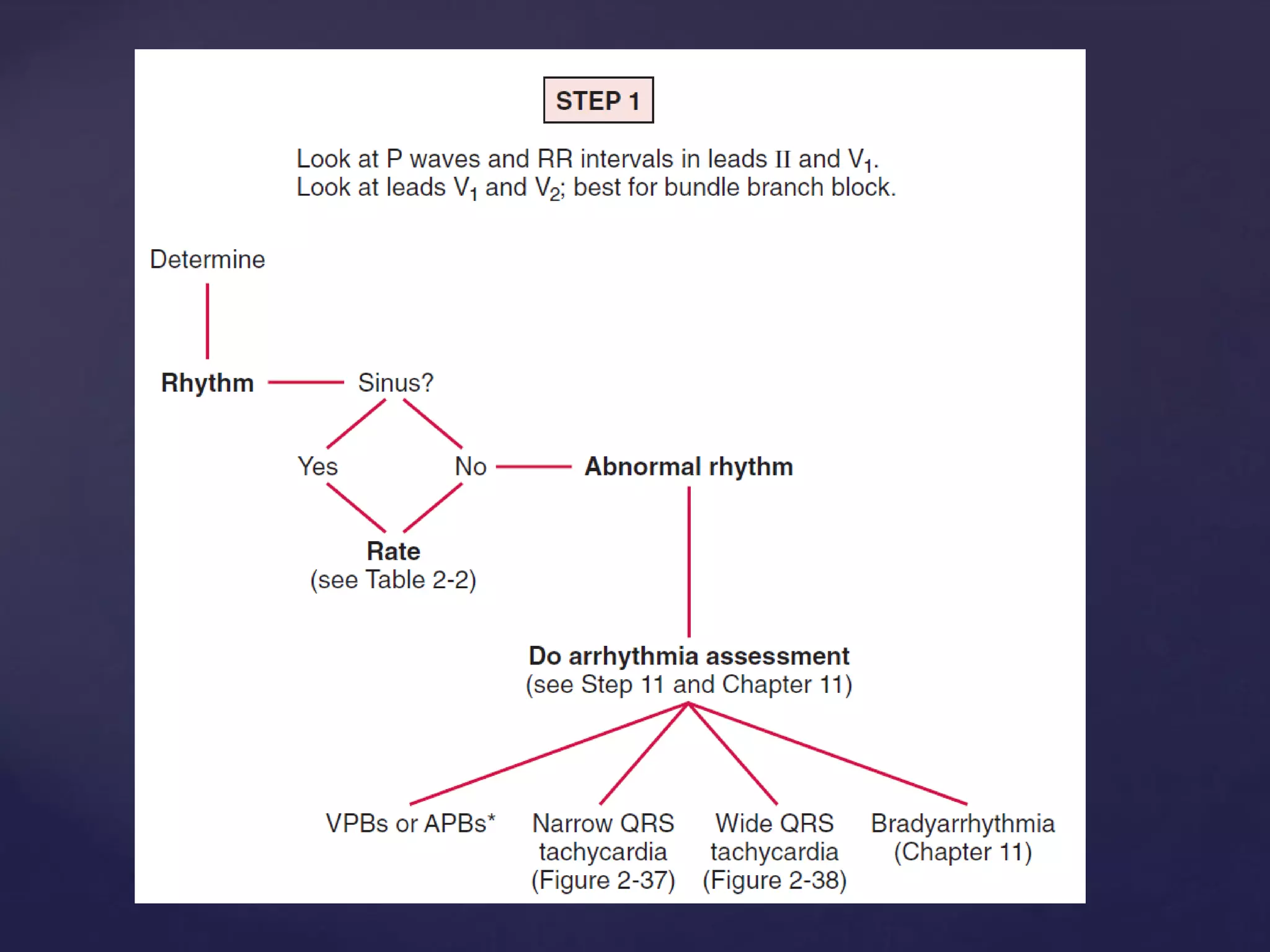 Rapid interpretation of ECG | PPT