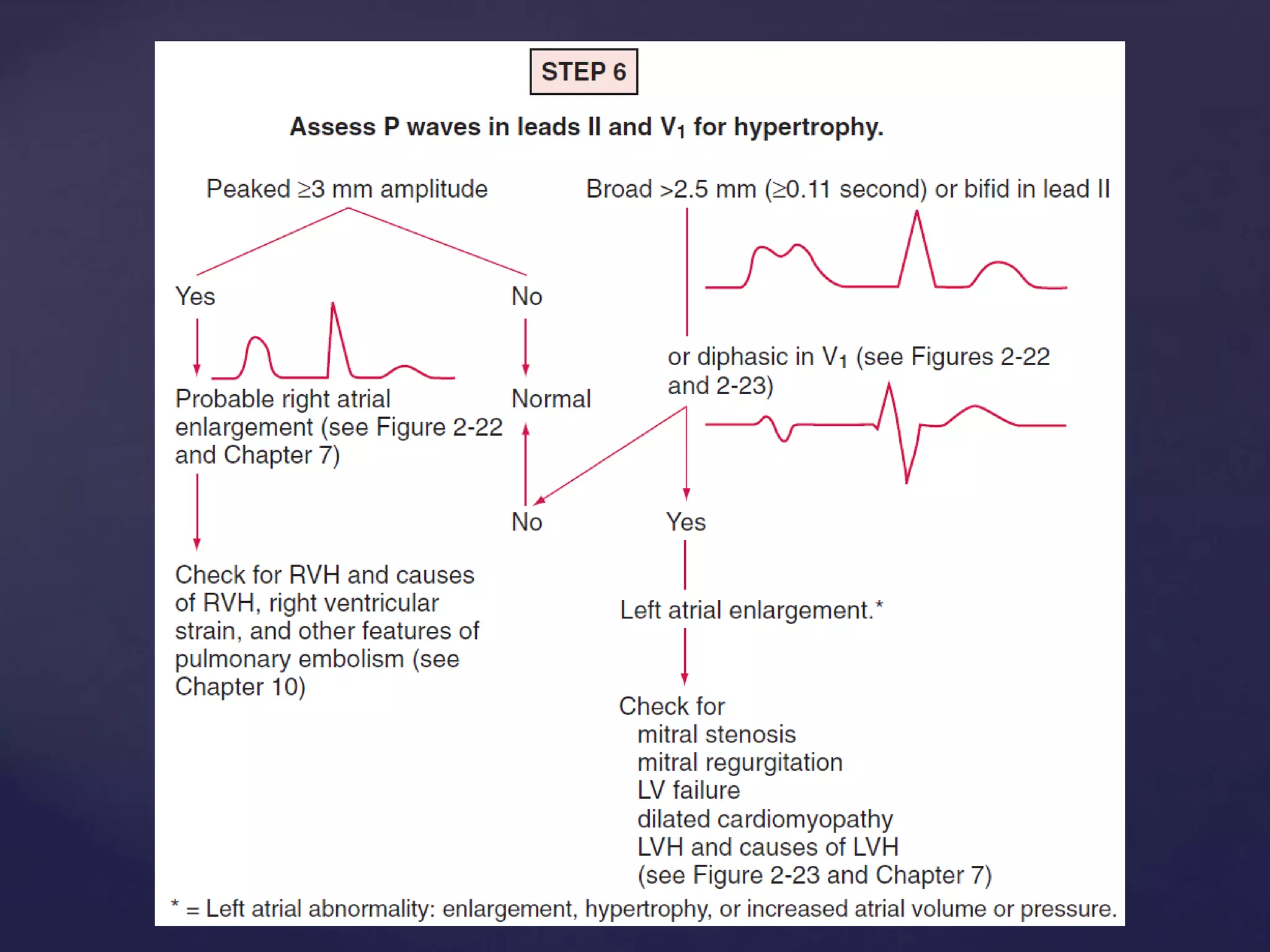 Rapid interpretation of ECG | PPT