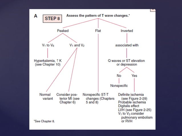 Rapid interpretation of ECG | PPT