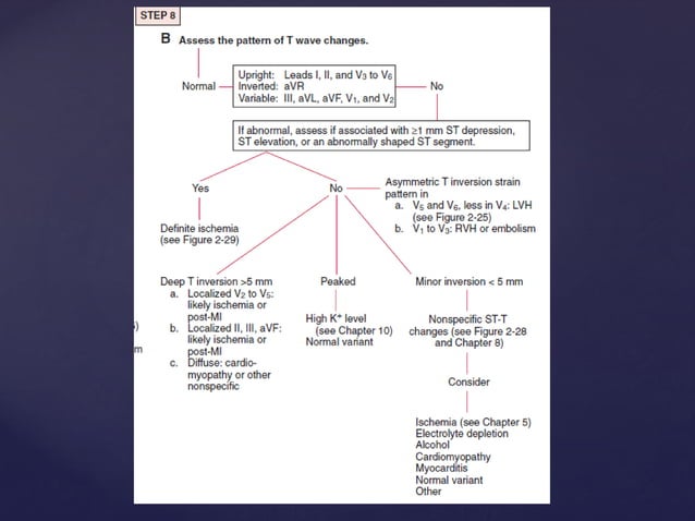 Rapid interpretation of ECG | PPT