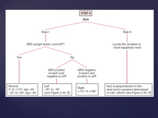 Rapid interpretation of ECG | PPT