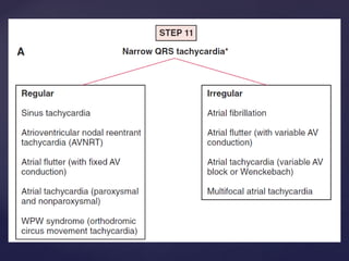 Rapid interpretation of ECG | PPT