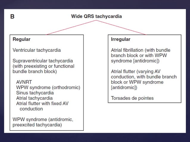 Rapid interpretation of ECG | PPT